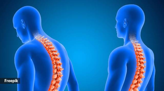 New age surgery helps 65-year-old walk after a spine fracture | Health ...