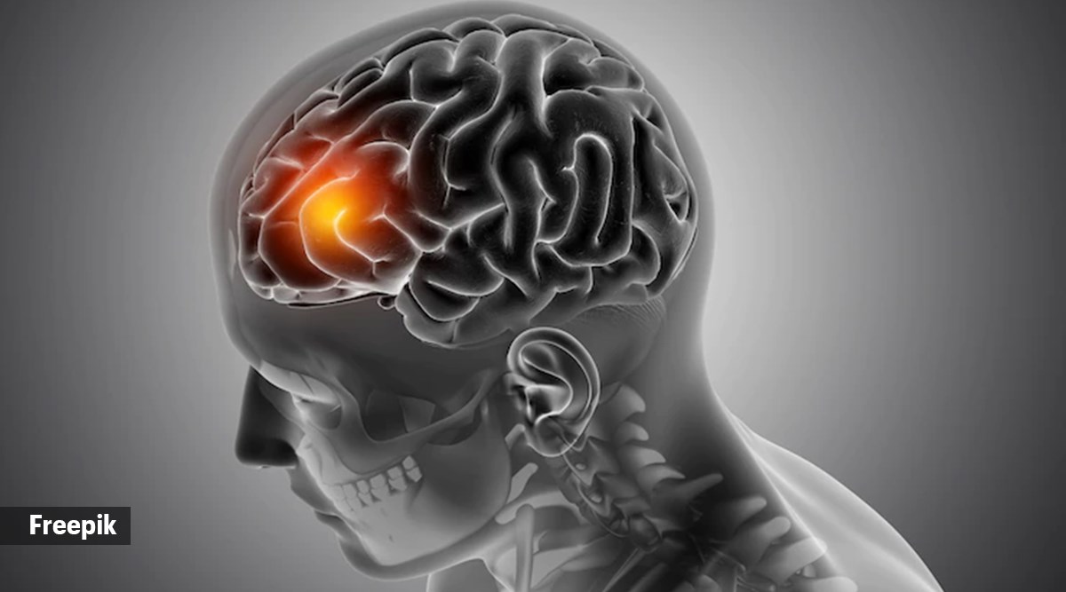 World Brain Day: Understanding reasons for rise in brain strokes among ...