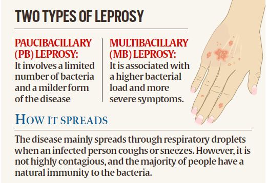 Leprosy cases spike after Covid, 77% patients in advanced stage ...