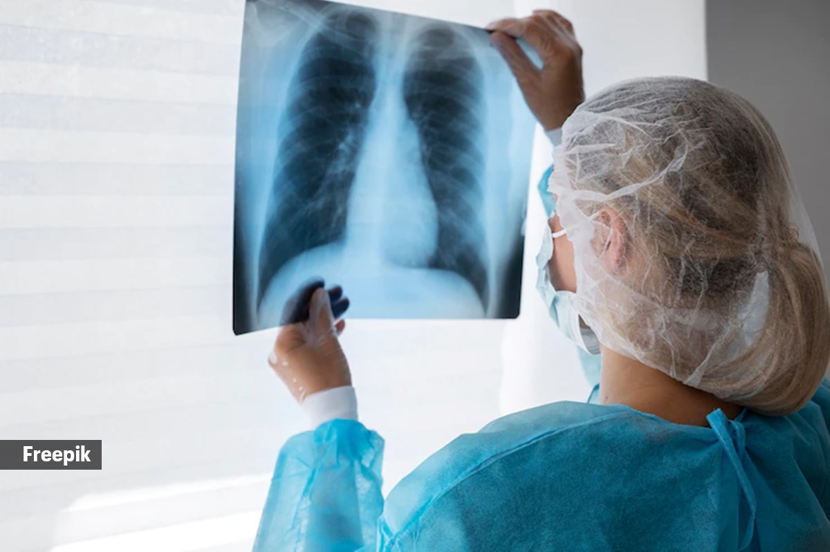 World Lung Cancer Day: What is targeted therapy? How does it give an ...