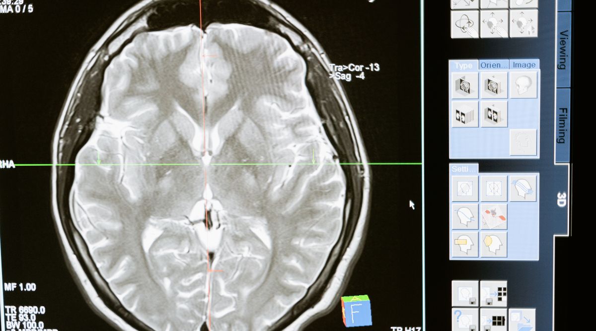 New AI tool diagnoses brain tumors on the operating table | Technology ...