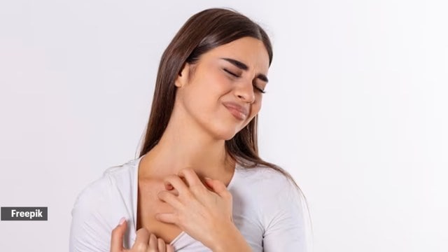 What you thought is a stress rash is probably one of these 5 things ...