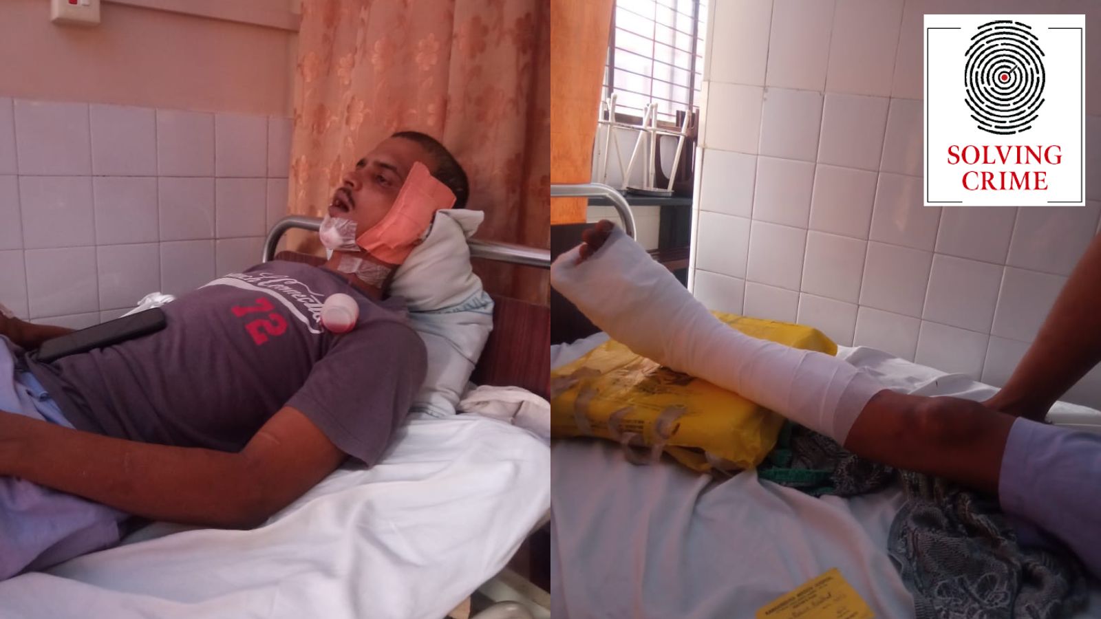 Solving Crime | 2 teeth and a fractured leg: How Mumbai police caught ...