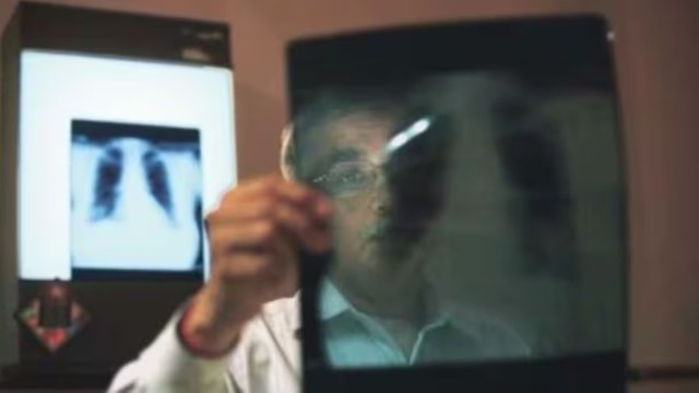 ICMR study leads to unique non-invasive method of SmaRT-PCR mask to ...