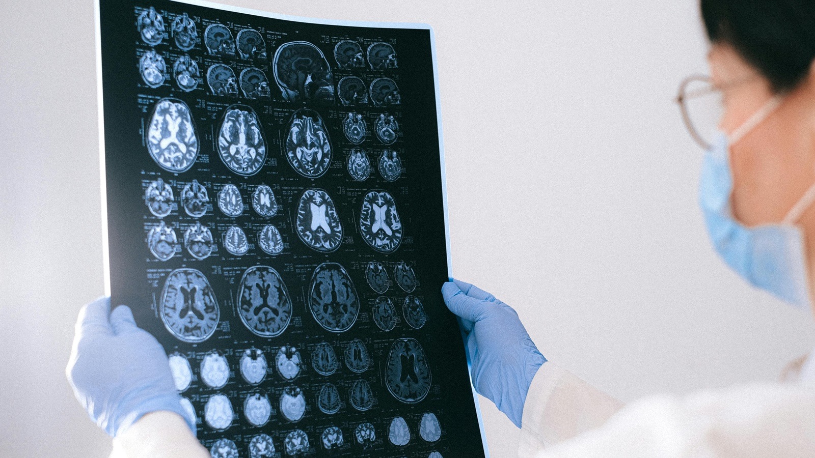 New Alzheimer’s drug: US expert panel greenlights FDA approval for ...