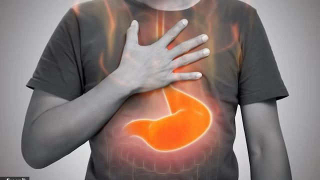 First UK patients get implant to stop acid reflux and heartburn: What ...