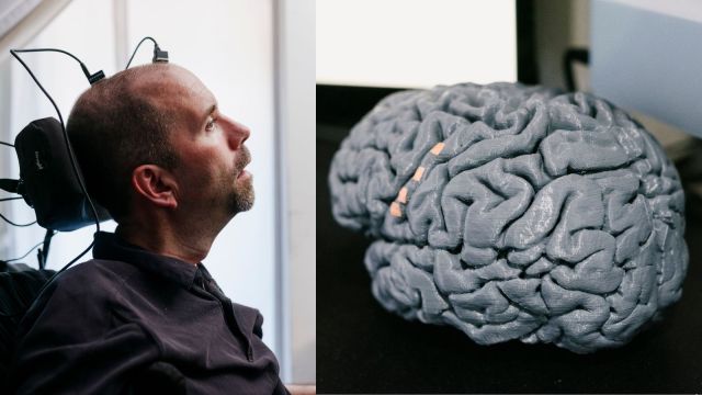 ALS stole his voice. AI retrieved it. | World News - The Indian Express