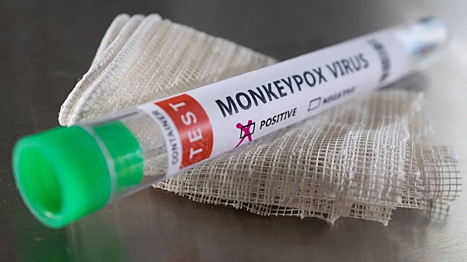 Monkeypox virus has struck Africa again, leaving continent scrambling ...
