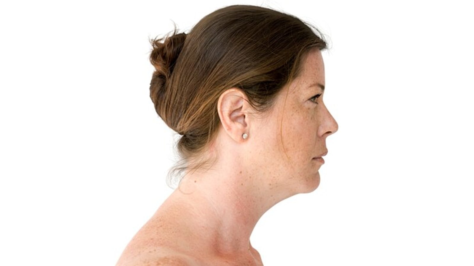 Measuring your neck fat could explain your breathing issues | Health ...