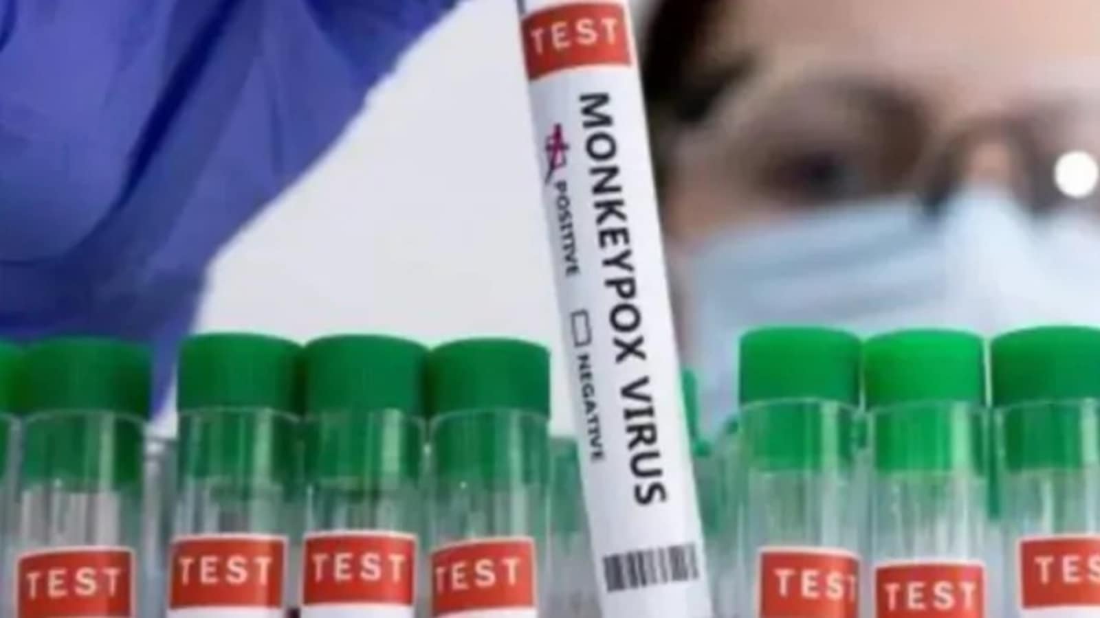 Mpox symptoms in Kerala man who travelled to UAE, hospitalised | India ...