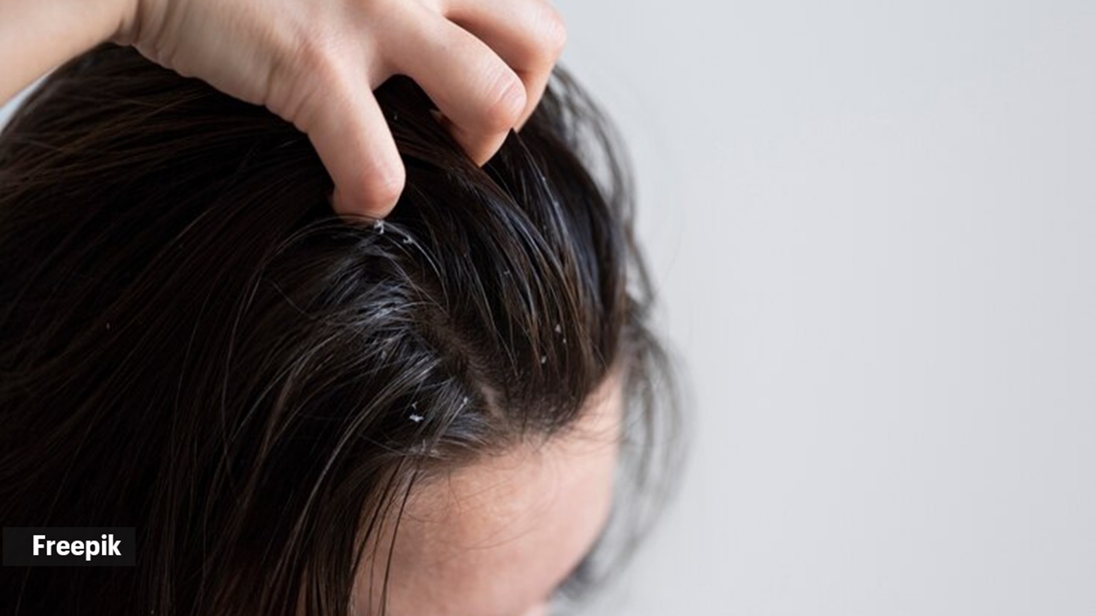 How common is lice in adults?