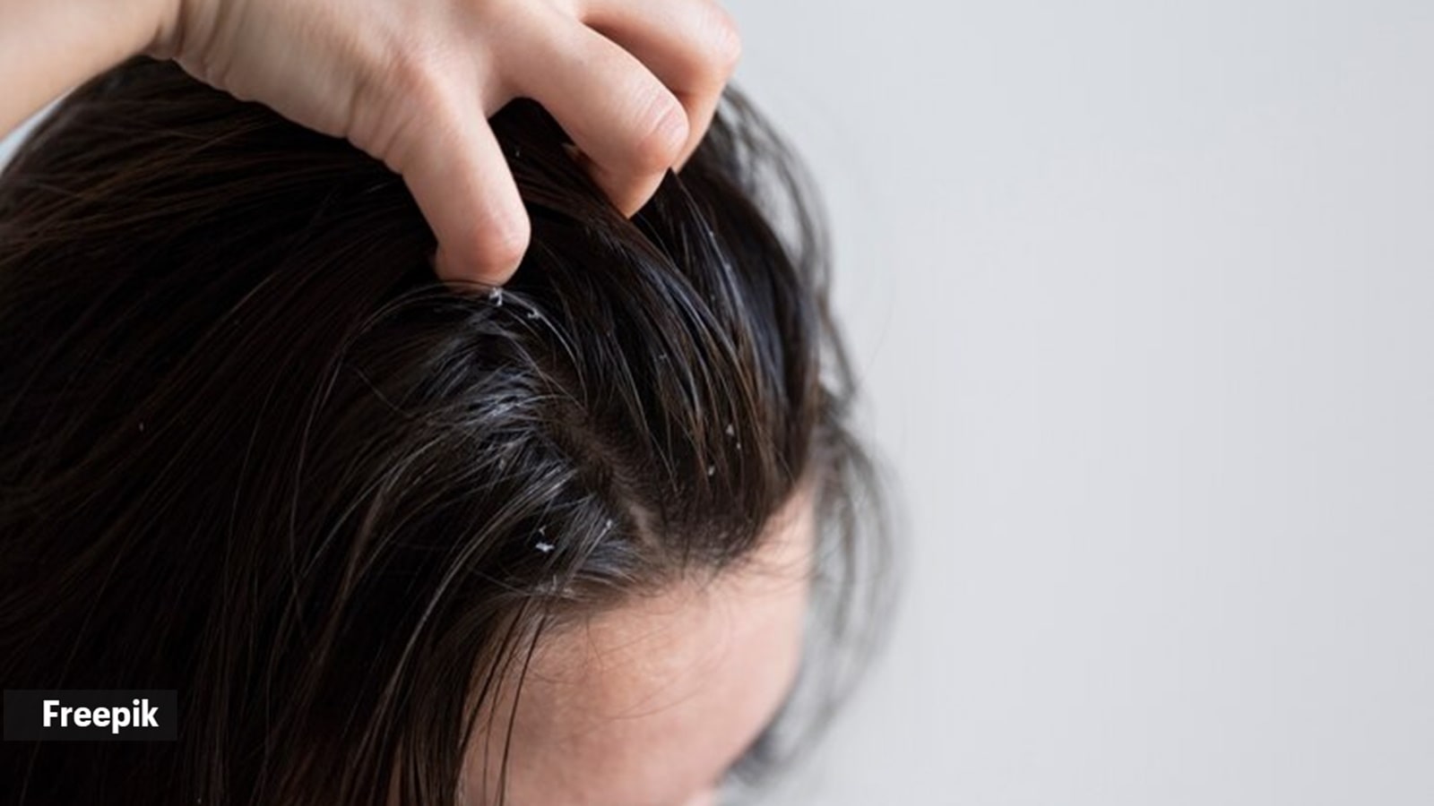 How common is lice in adults?
