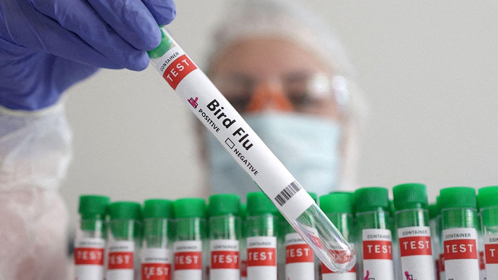 Bird flu mutations found in first severe US human case, CDC reports ...