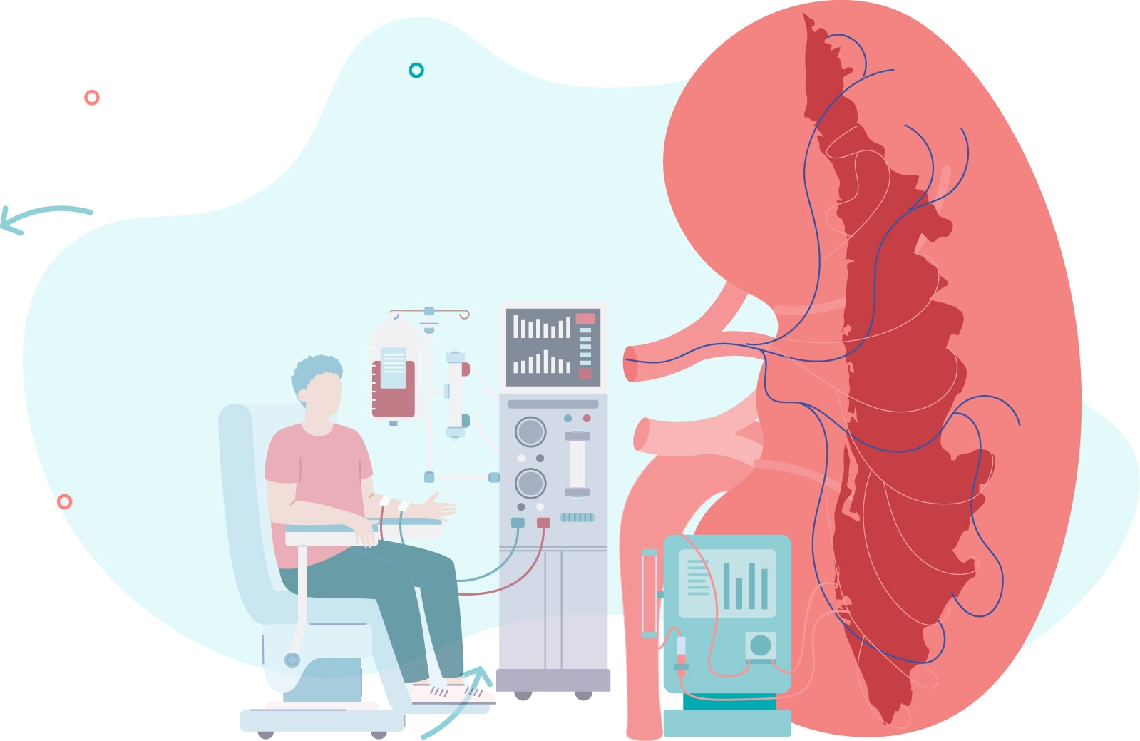 Kerala villages, PHCs at the forefront of state’s dialysis challenge ...
