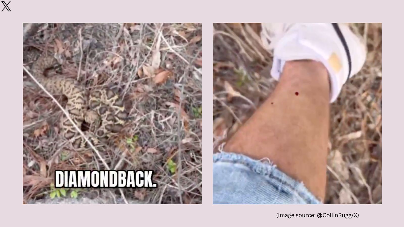 Florida influencer gets bit by deadly rattlesnake, continues filming ...
