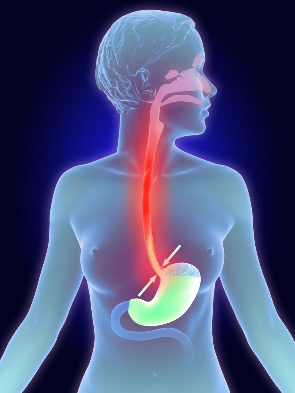 The silent link between acid reflux and tooth sensitivity