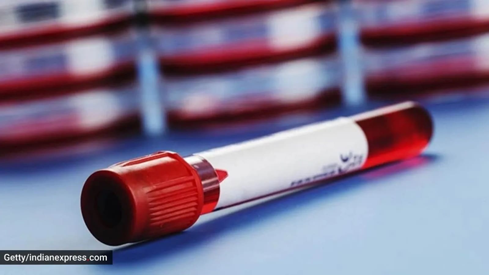 A, O, or AB: Is one blood group likely to feel hotter than others ...