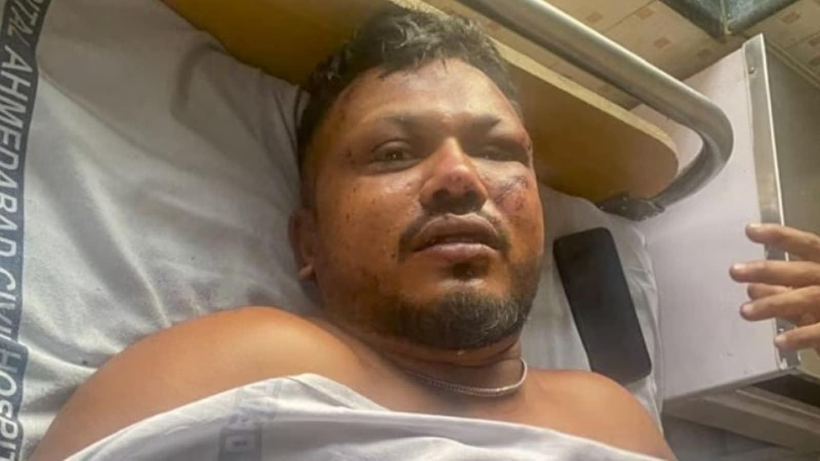 Air India plane crash survivor Vishwas Ramesh discharged, brother’s body handed over to family ...