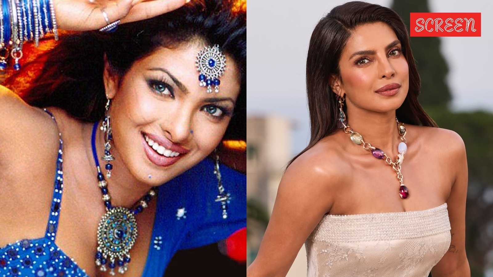 Priyanka Chopra looked like nothing, was dark-skinned and skinny ...