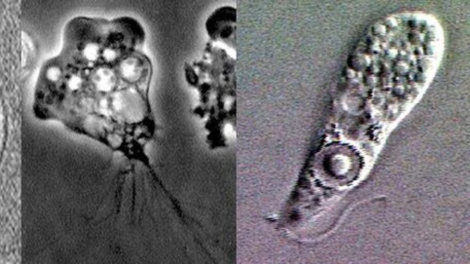 Everything You Need to Know About the New Brain-Eating Amoeba ...