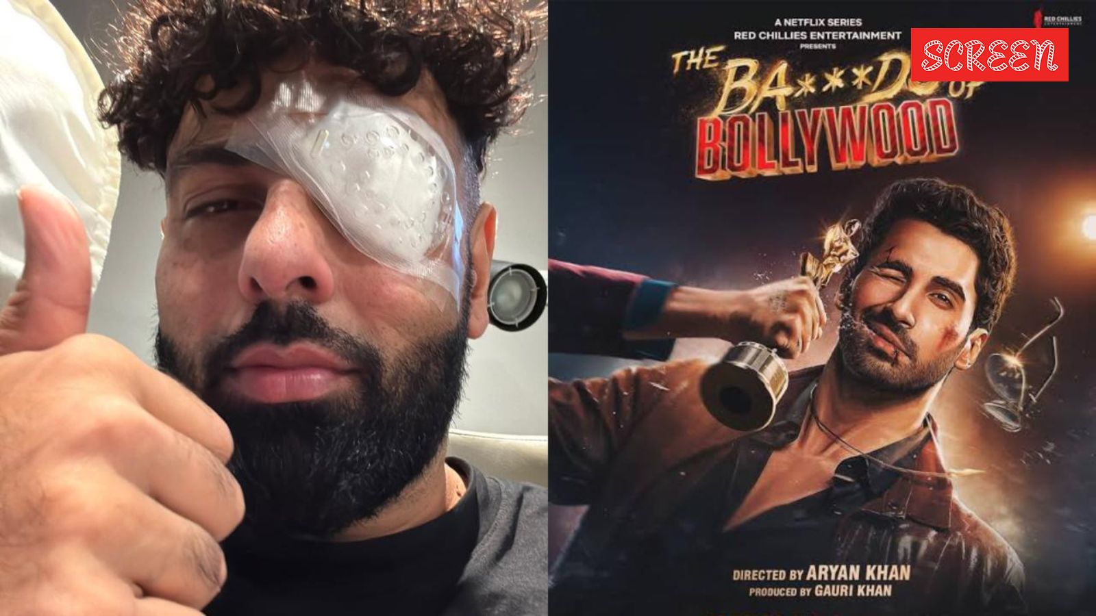 Badshah sports eye patch after injury, links the injury to The Ba***ds ...