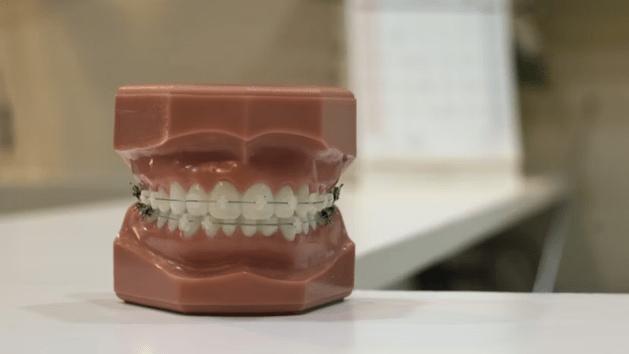 The link between oral health and heart disease | Lifestyle Gallery News ...