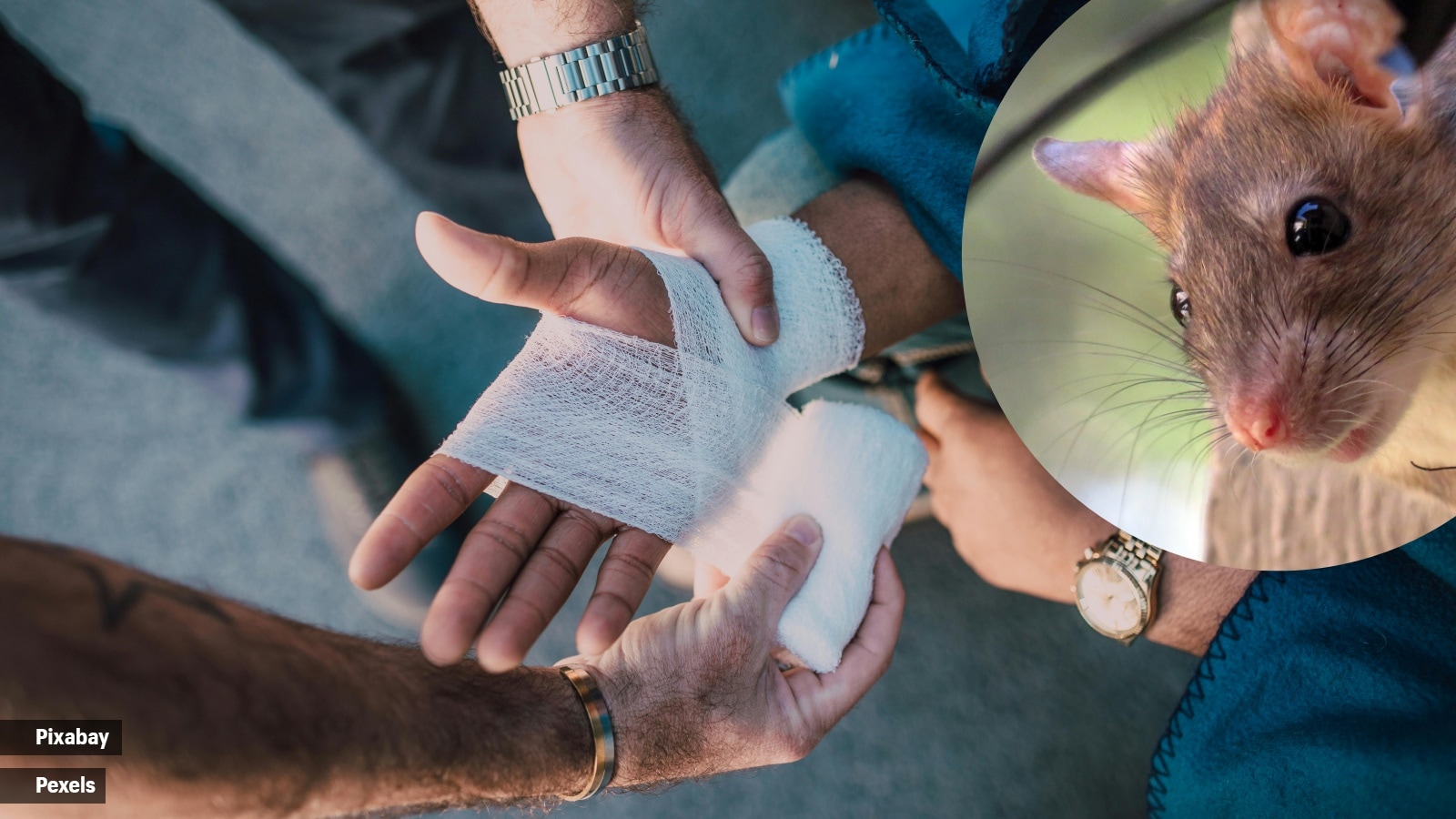 What to do after a rat bite: First aid, tetanus, and infection ...