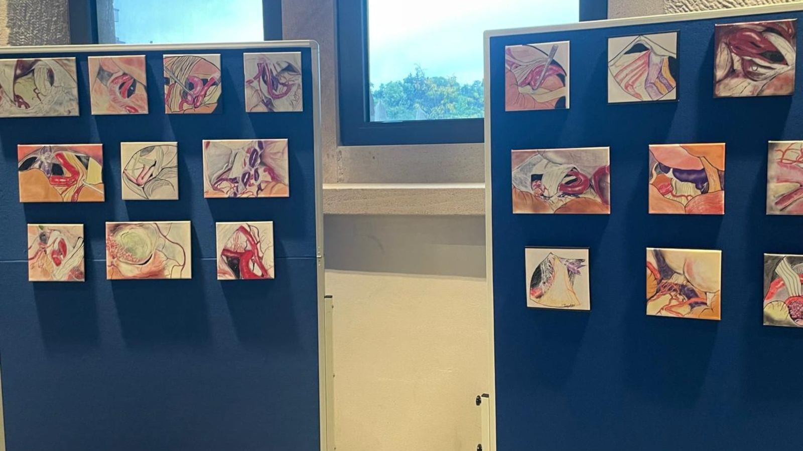 When medicine meets art: Pune neurosurgeon’s paintings capture brain’s hidden beauty, its ...