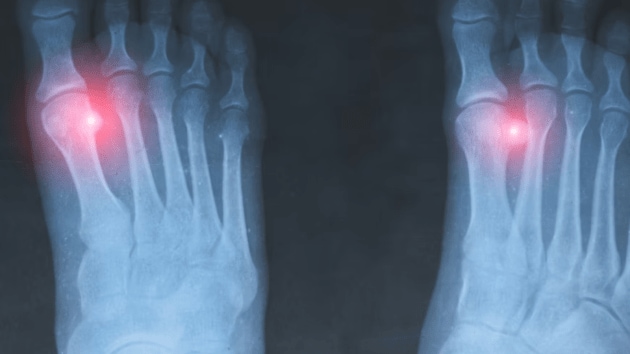 This is what happens to the body when you have olive oil every day ...