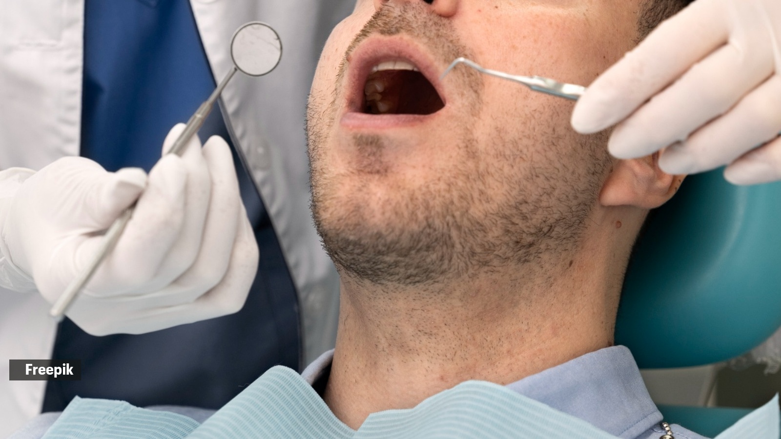 Why Space Agencies Want Your Wisdom Teeth Out First